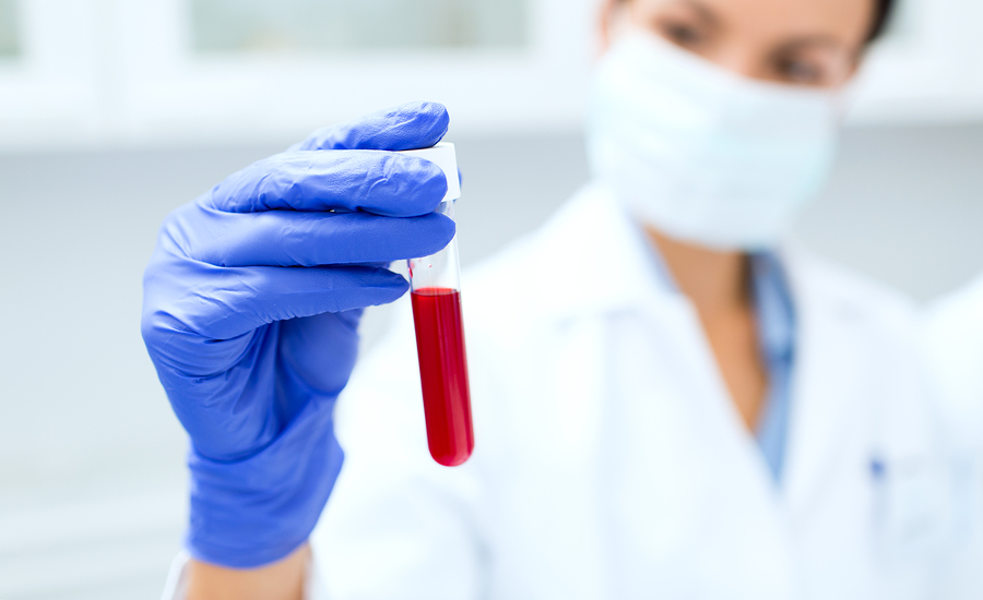 New Blood Test Predicts Mild TBI Brain Bleeds - Premiere Research Institute